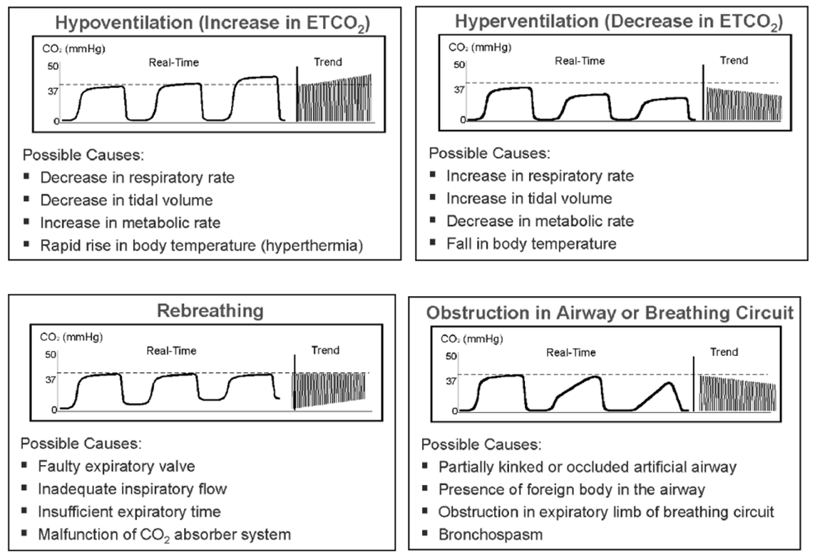 Measuring CO2 Levels During Anesthetic Procedures - TRH Services